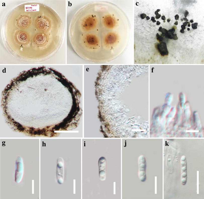 Fungal diversity notes 367–490: taxonomic and phylogenetic ...