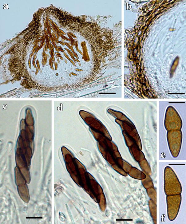 Fungal diversity notes 367–490: taxonomic and phylogenetic ...
