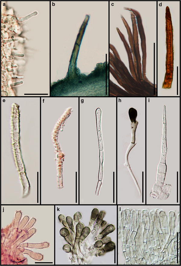 DISCOMYCETES: the apothecial representatives of the phylum Ascomycota ...