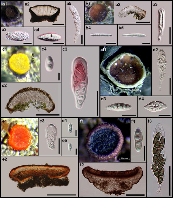DISCOMYCETES: the apothecial representatives of the phylum Ascomycota ...