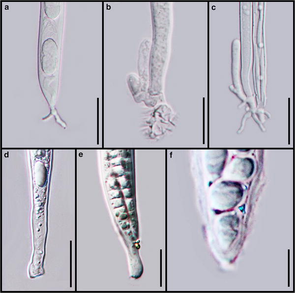 DISCOMYCETES: the apothecial representatives of the phylum Ascomycota ...