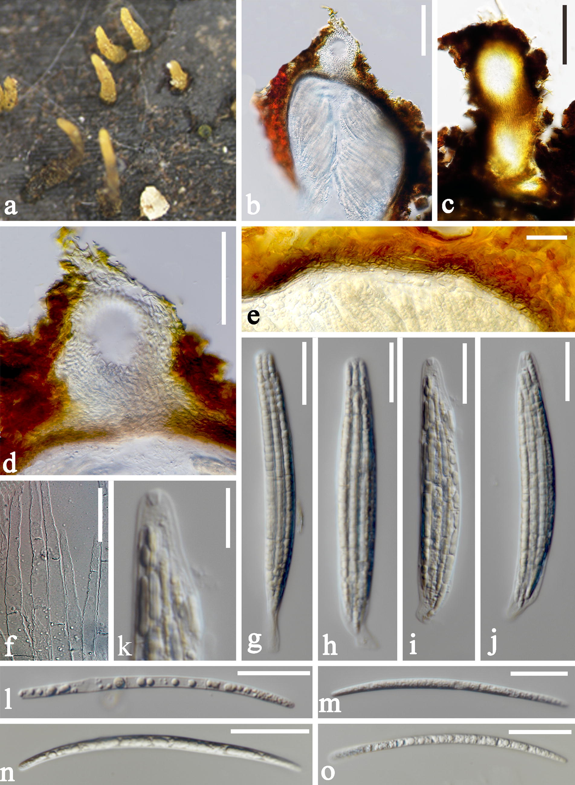 Freshwater Sordariomycetes | SpringerLink