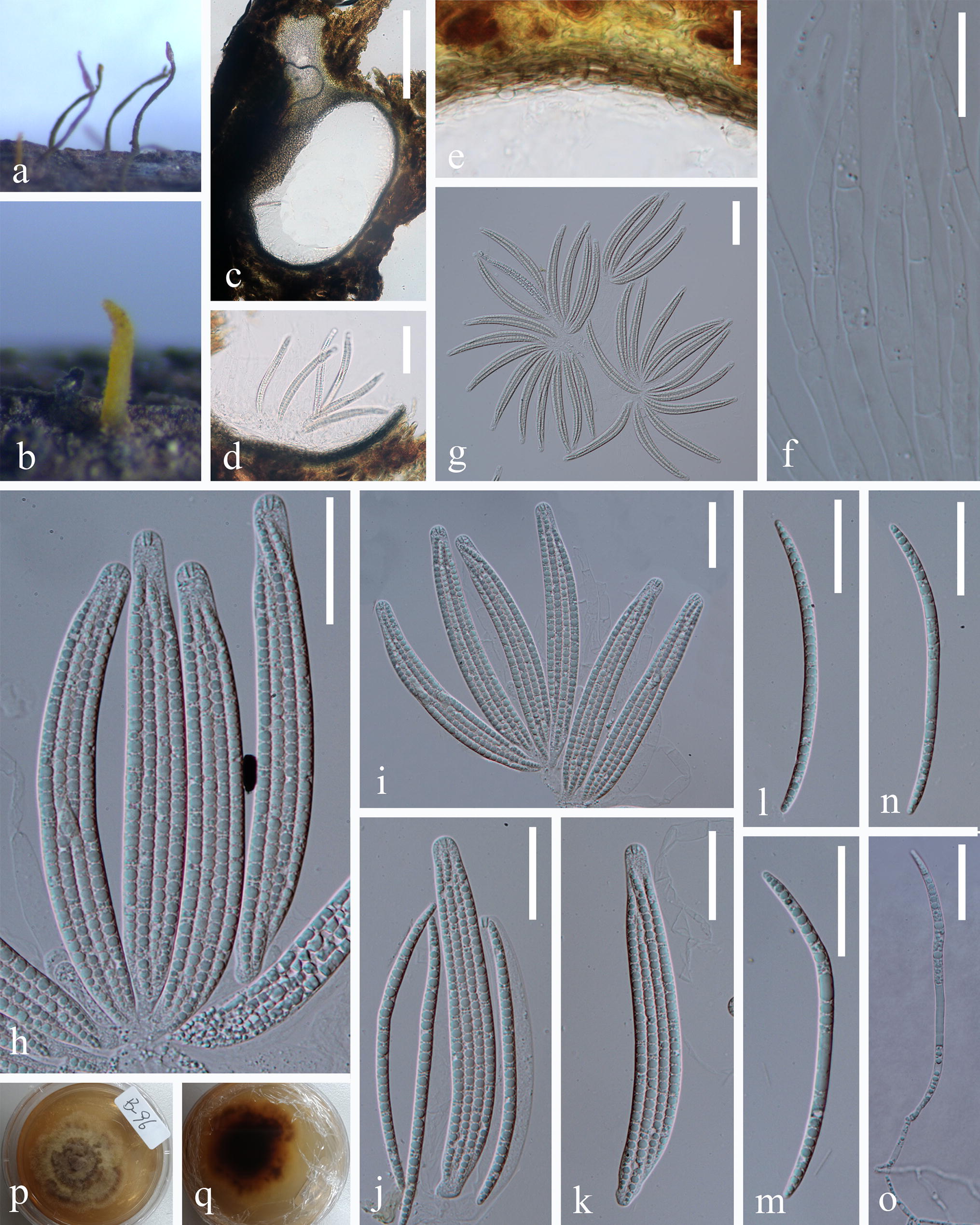 Freshwater Sordariomycetes | SpringerLink