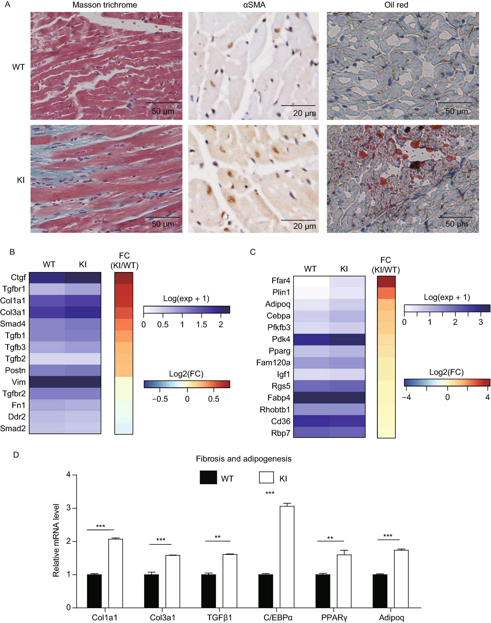 TMEM43-S358L mutation enhances NF-κB-TGFβ signal cascade in ...