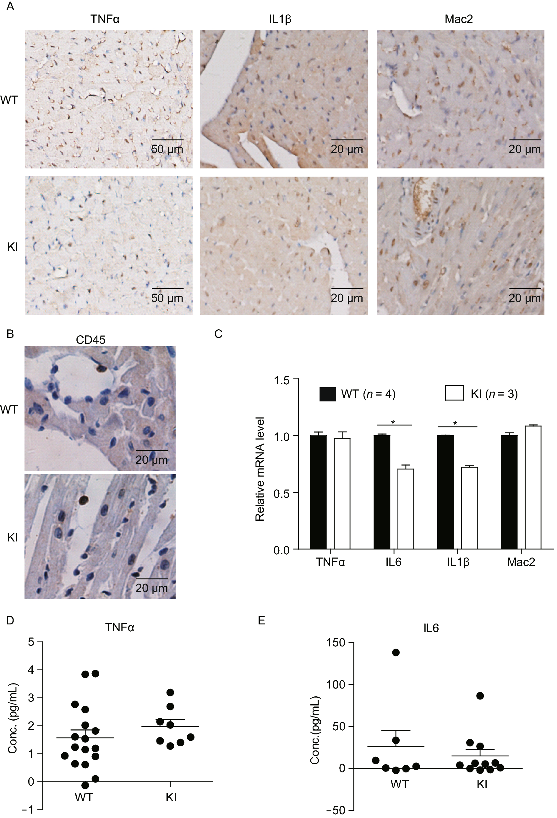 TMEM43-S358L mutation enhances NF-κB-TGFβ signal cascade in ...