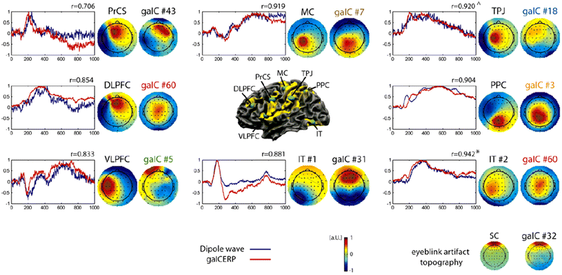 Simultaneous EEG-fMRI for working memory of the human brain | SpringerLink