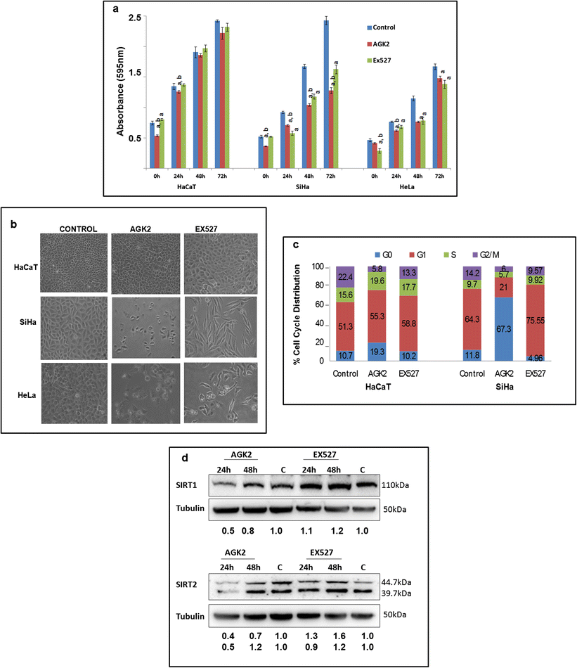Expression/localization patterns of sirtuins (SIRT1, SIRT2, and SIRT7 ...