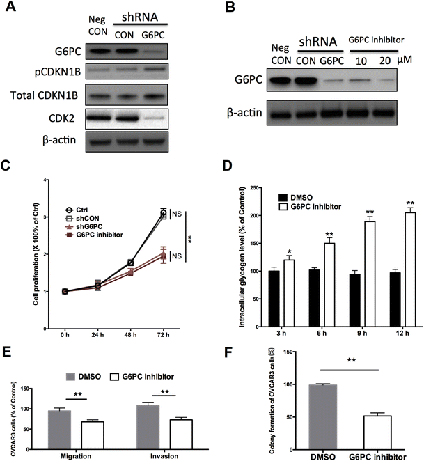 Genetic and molecular analyses reveal G6PC as a key element connecting ...