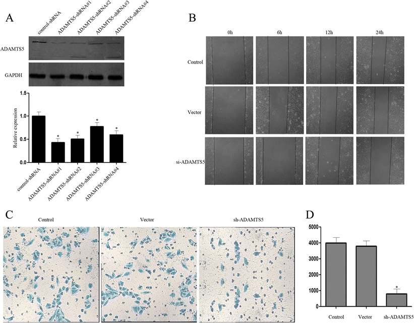 Overexpression of ADAMTS5 can regulate the migration and invasion of ...