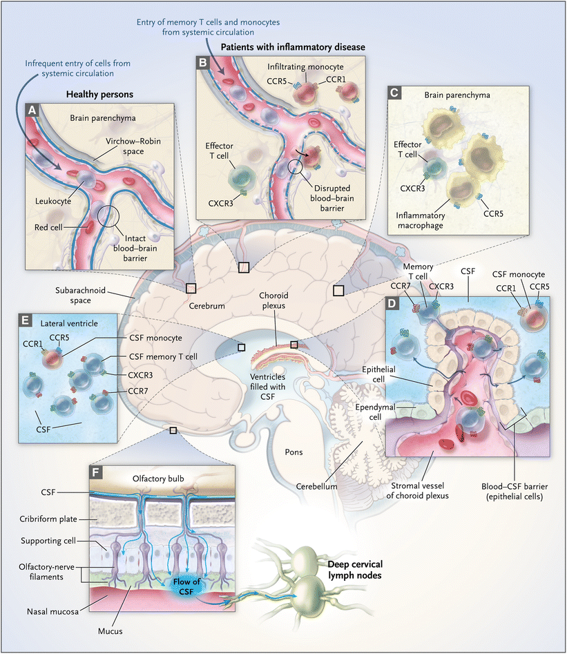 Neuroinflammation: Ways in Which the Immune System Affects the Brain ...