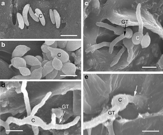 Histological and cytological investigations of the infection and ...