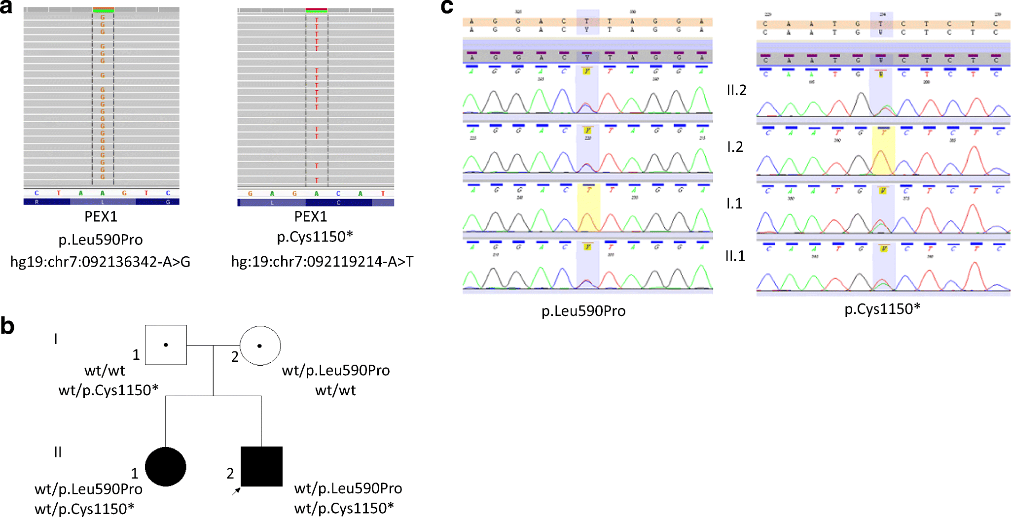 Mild Zellweger syndrome due to functionally confirmed novel PEX1 ...