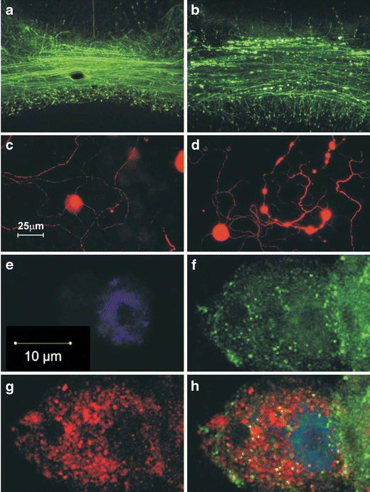 Diabolical effects of rabies encephalitis | SpringerLink