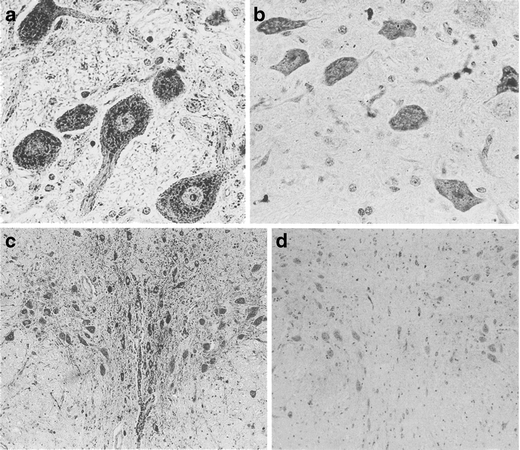 Diabolical effects of rabies encephalitis | SpringerLink