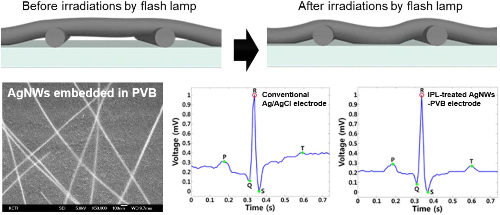 Conformable, Thin, and Dry Electrode for Electrocardiography Using ...