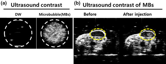 Microbubbles used for contrast enhanced ultrasound and theragnosis: a ...