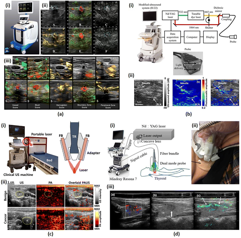 Clinical photoacoustic imaging platforms | SpringerLink