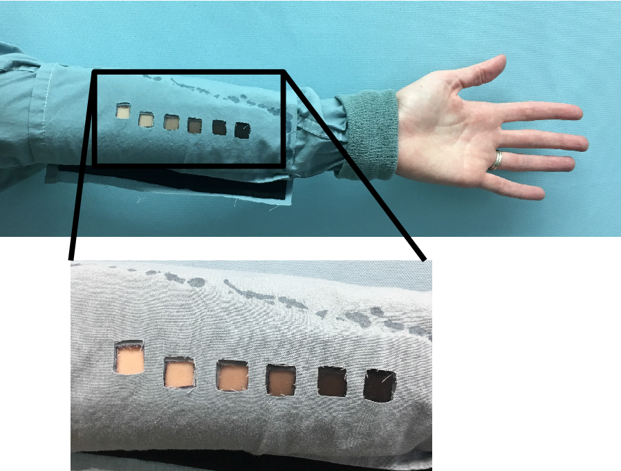 A Rapid and Cost-Effective Device for Testing Minimal Erythema Dose ...