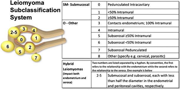 Endoscopic Treatment and Power Morcellation of Uterine Fibroids ...