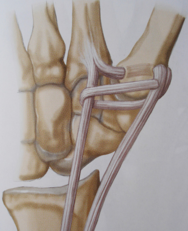 Stadiengerechte Rhizarthrose-Therapie | SpringerLink