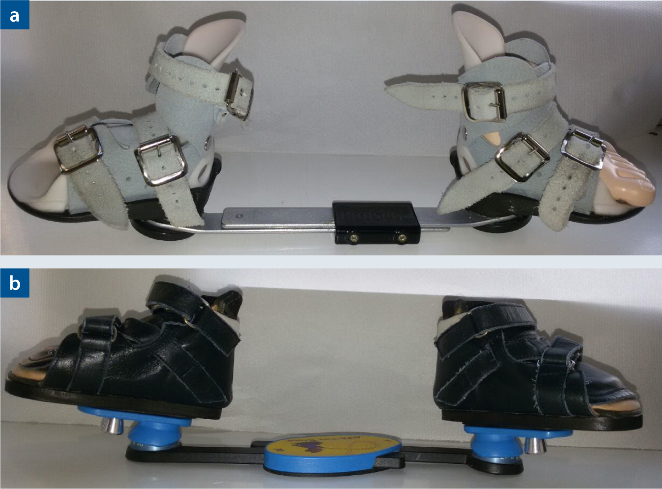 Therapie nach Ponseti: Goldstandard bei kongenitalen Klumpfüßen ...