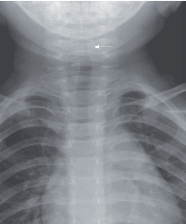 Kirchturm-Zeichen | SpringerLink