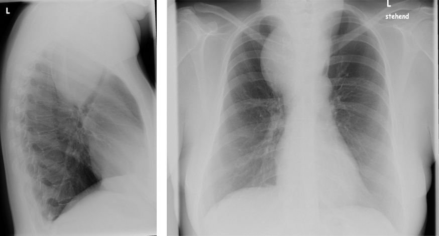 Woher kommt die Atemnot? | SpringerLink