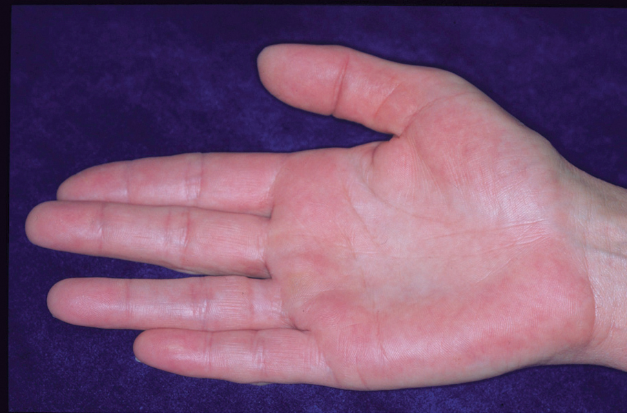 Wenn die Leber den Dienst versagt | SpringerLink