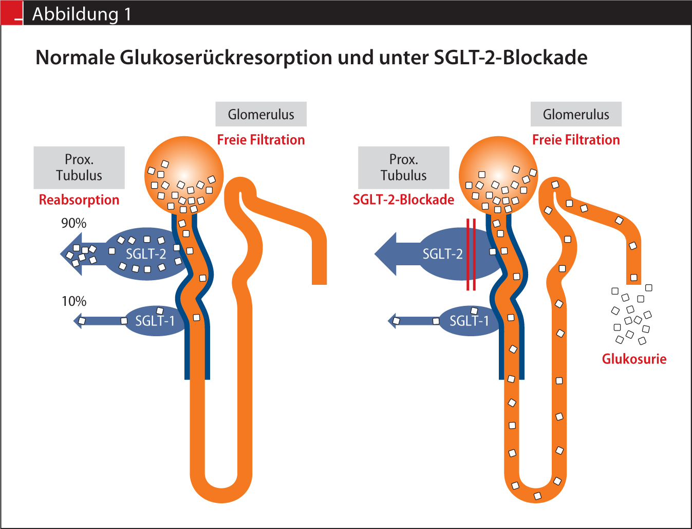 Welchen Stellenwert haben SGLT-2-Blocker? | SpringerLink