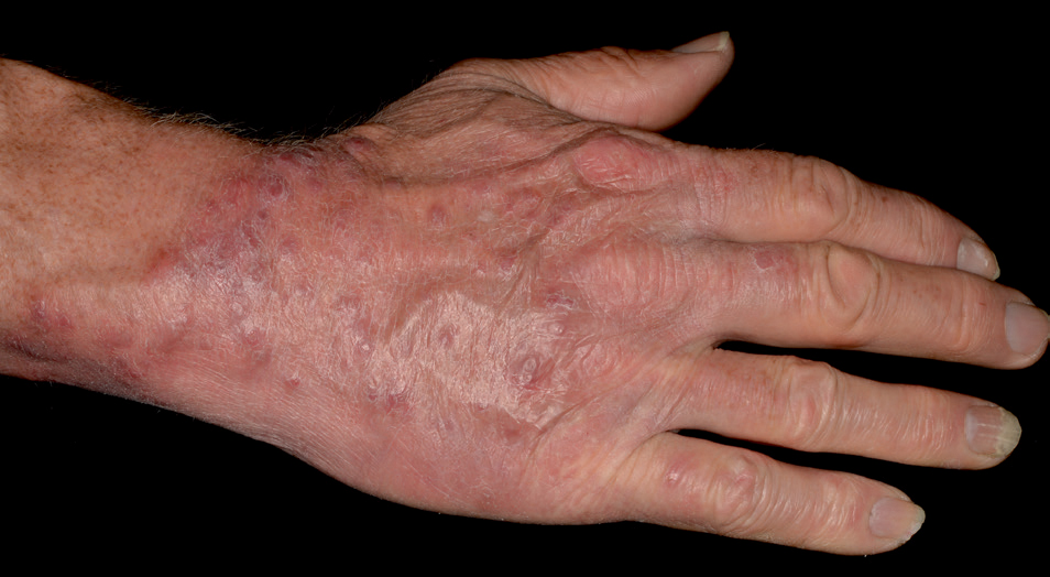 Rote Hand - was tun? | SpringerLink