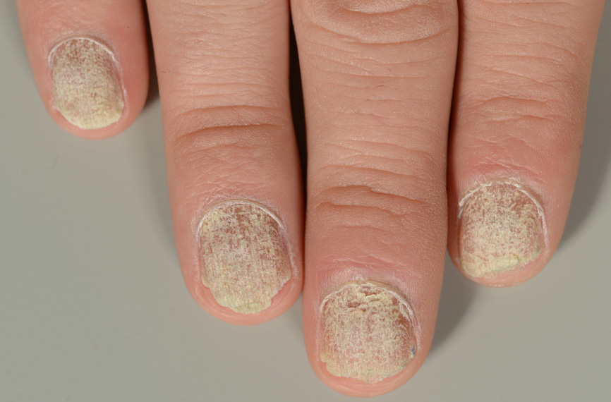 Was haben sie zu bedeuten? | SpringerLink