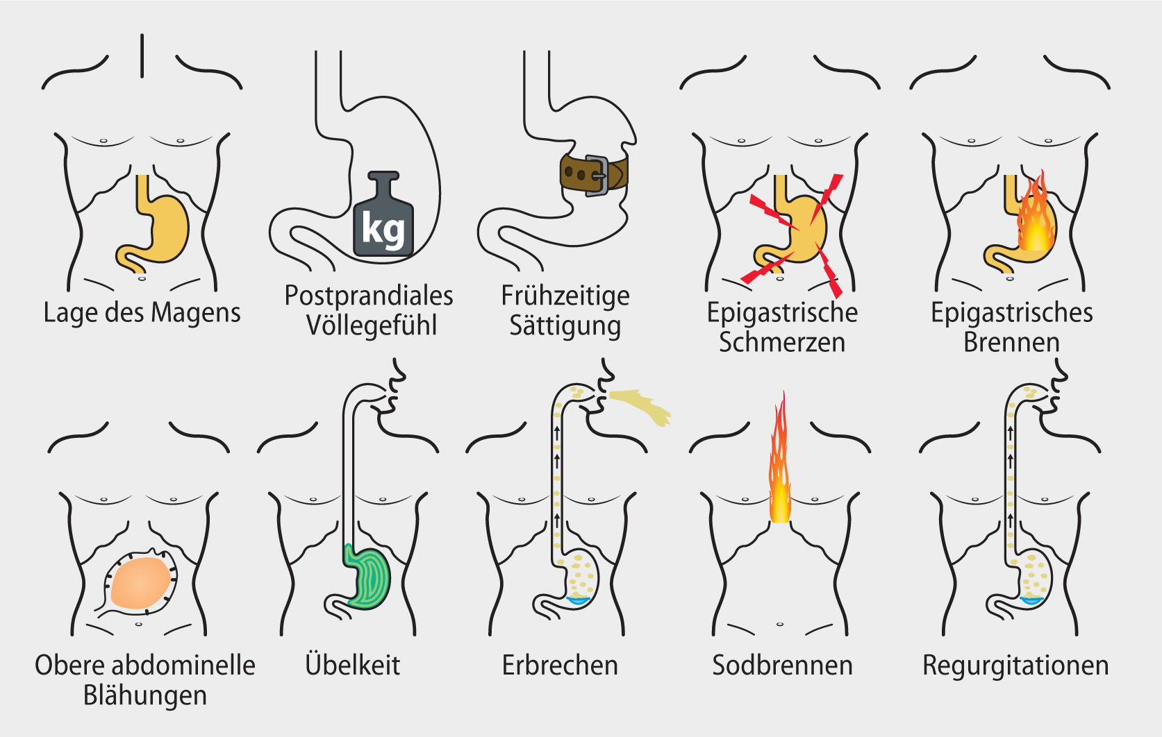 Pathophysiologie, Diagnostik und Therapie bei funktioneller Dyspepsie ...