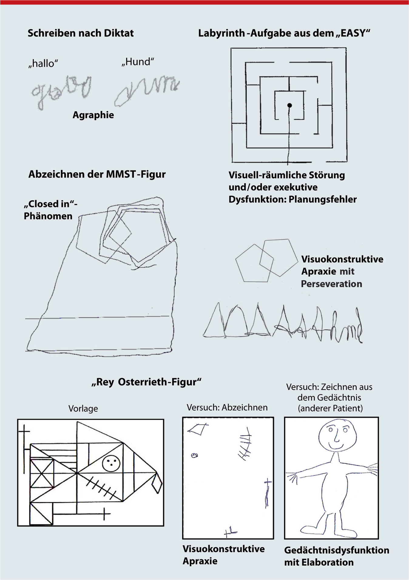 Demenz — welcher Test kann was? | SpringerLink