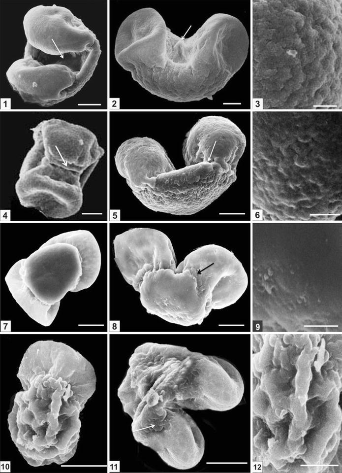 Scanning Electron Microscopic Study of Some Saccate Pollen Grains of ...
