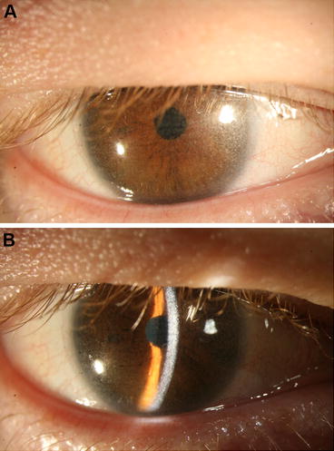 Clinical Practice: A Proposed Standardized Ophthalmological Assessment ...