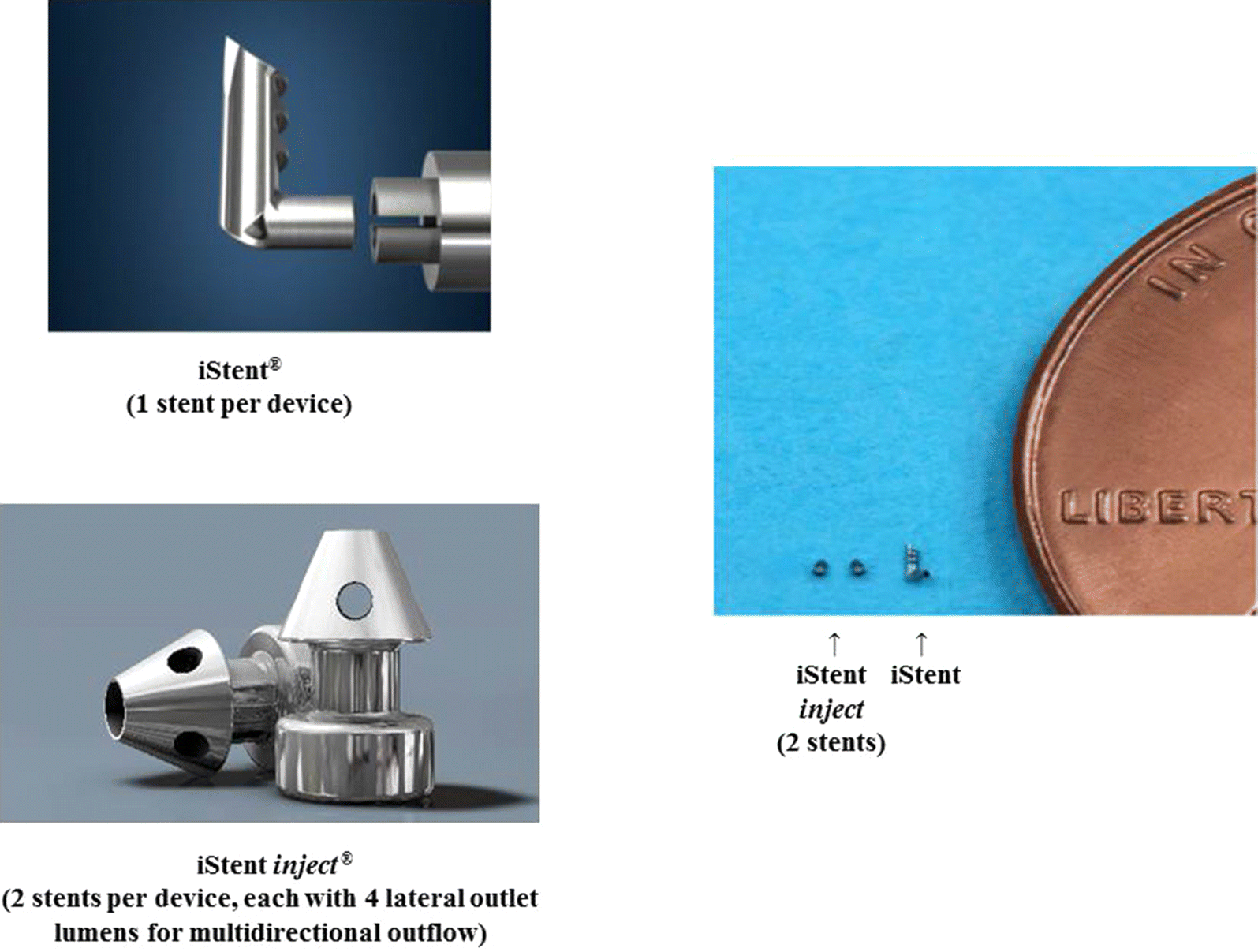 Real-world Case Series of iStent or iStent inject Trabecular Micro ...