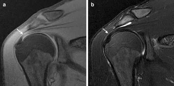 Anatomical Variants and Pitfalls in Magnetic Resonance Imaging of the ...