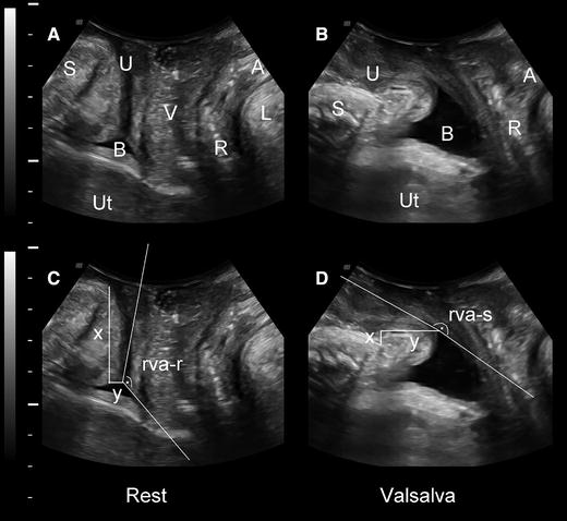 Pelvic Floor Ultrasound | SpringerLink