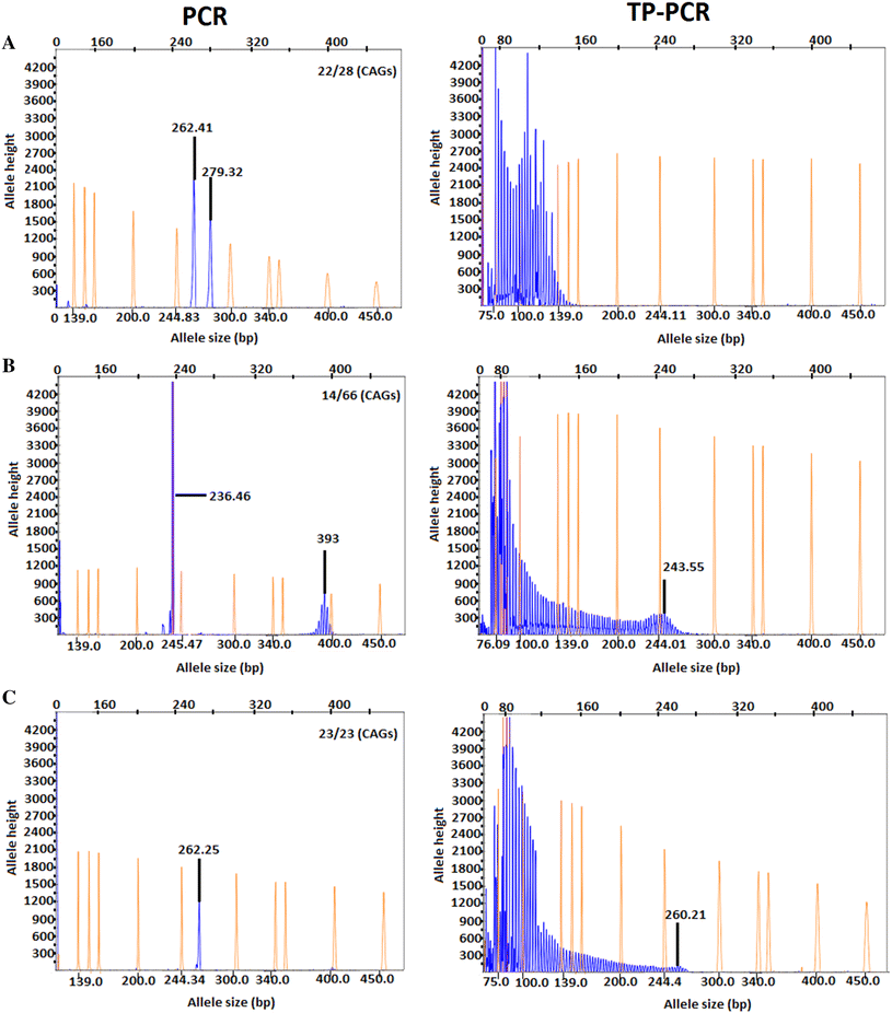 Triplet Repeat Primed PCR (TP-PCR) in Molecular Diagnostic Testing for ...