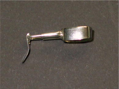 Optimal fit of chairside-fabricated distal shoe space maintainer ...