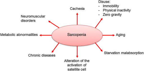 Sarcopenia: a predictor of mortality and the need for early diagnosis ...