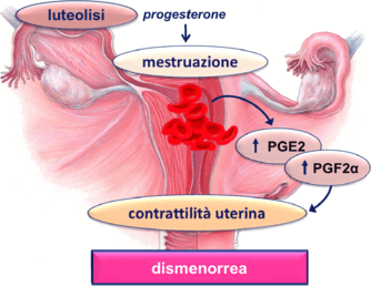 I disturbi della mestruazione nelle adolescenti: quale diagnosi e quale ...