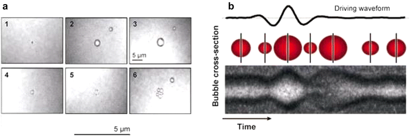 Ultrasound Cavitation/Microbubble Detection and Medical Applications ...