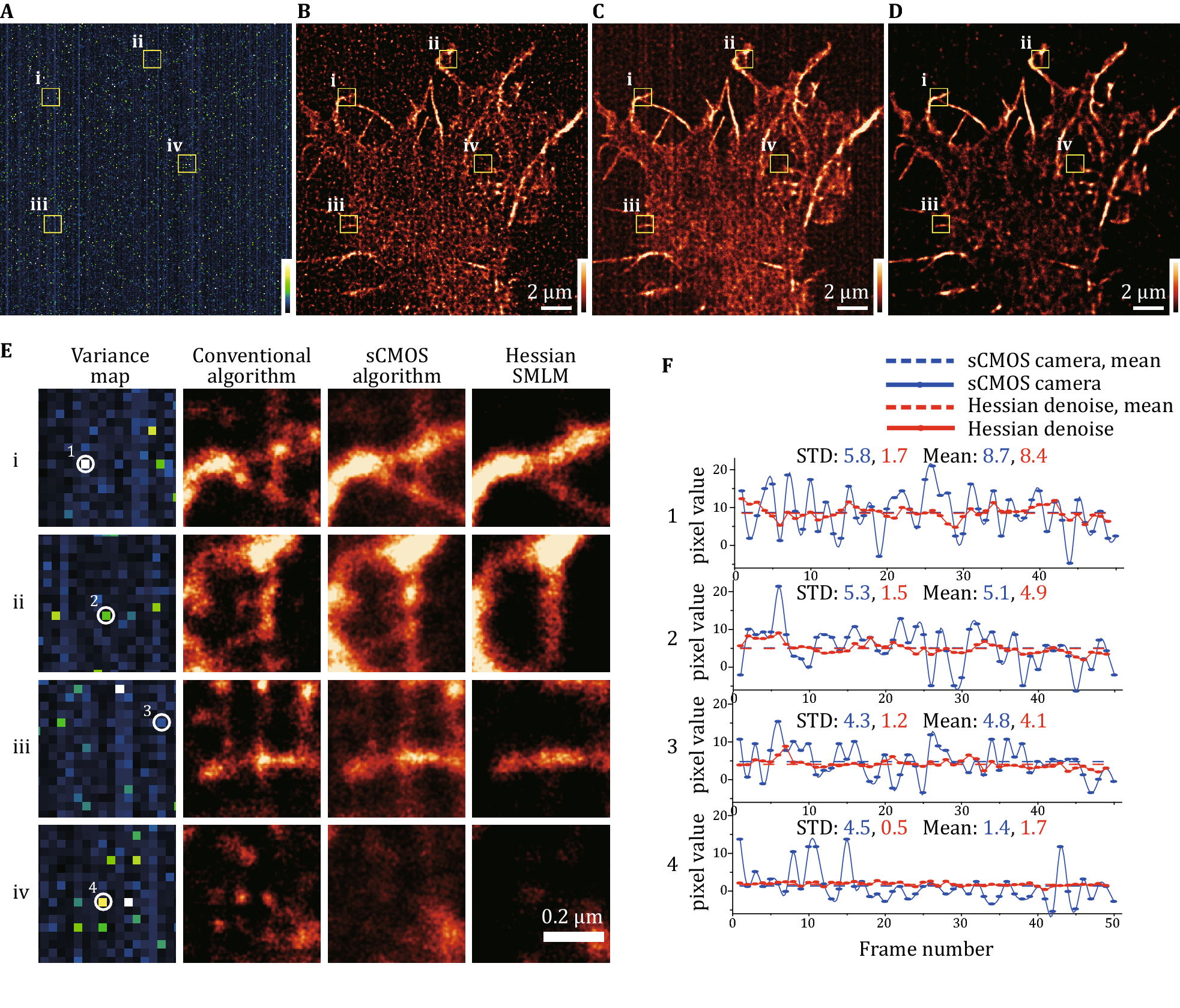 Hessian single-molecule localization microscopy using sCMOS camera | SpringerLink