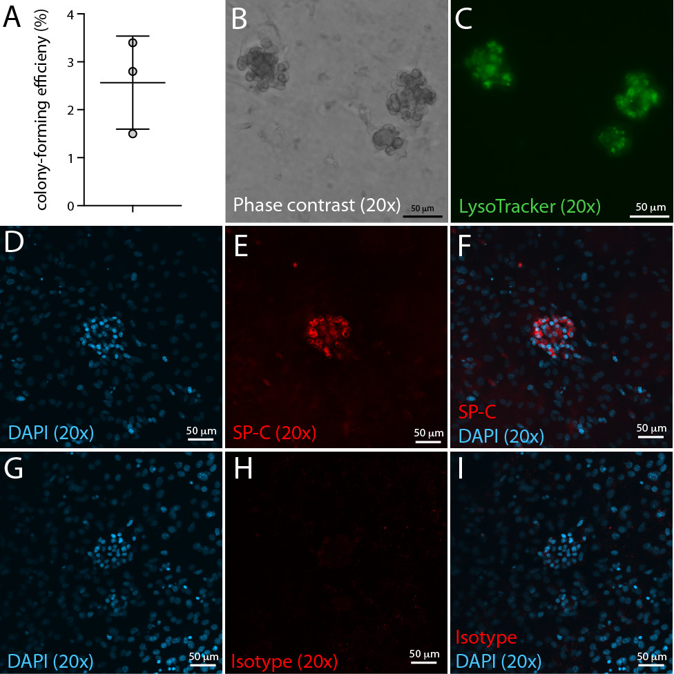 LysoTracker is a marker of differentiated alveolar type II cells ...