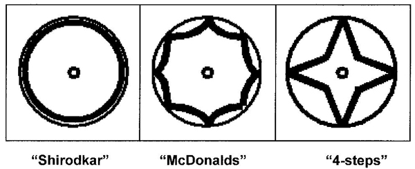 Clinical aspects of cervical insufficiency | SpringerLink