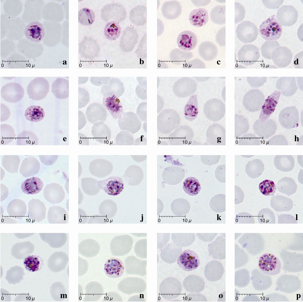 Morphological features and differential counts of Plasmodium knowles i ...