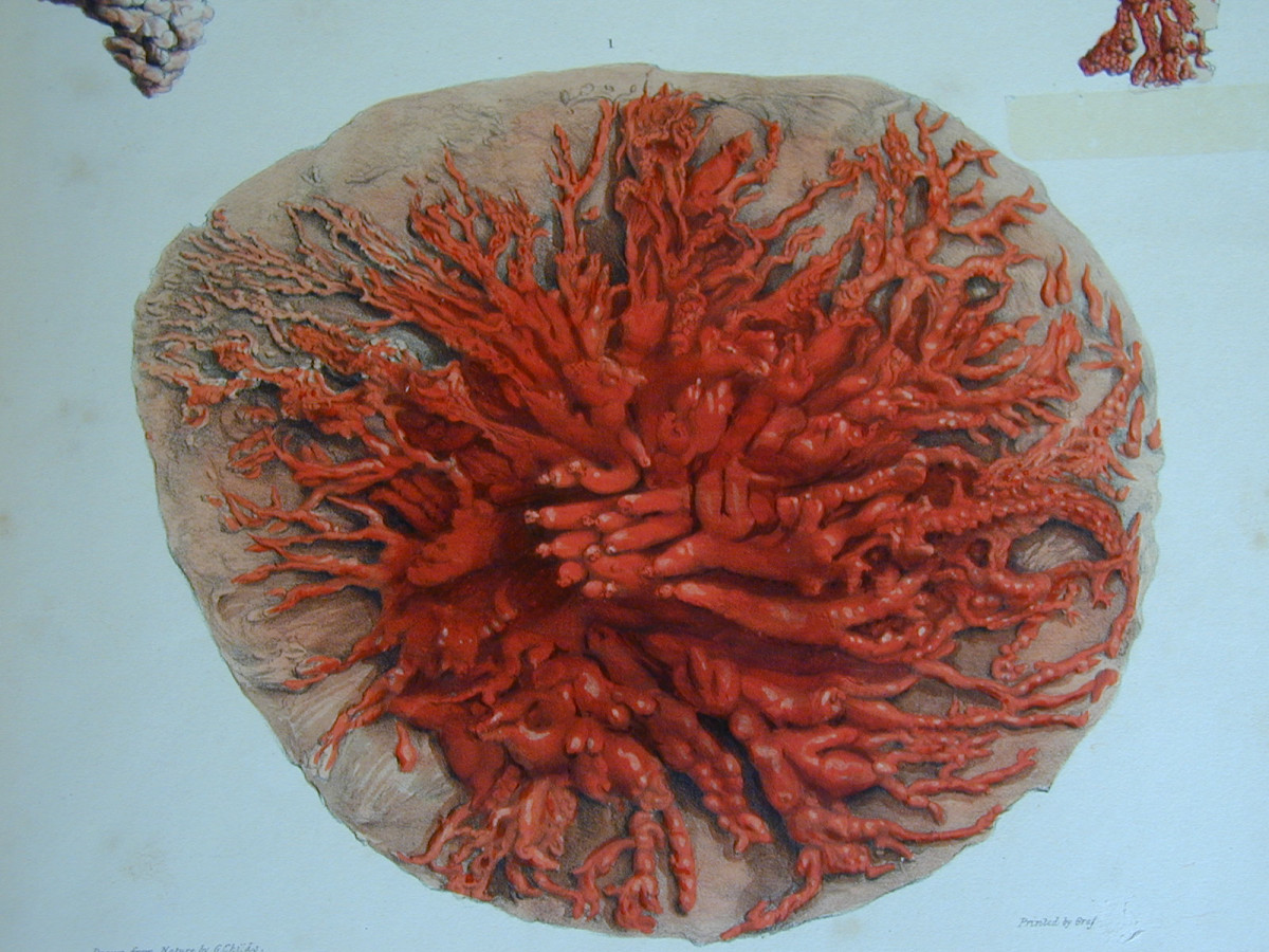 Ultrasound imaging of the lactating breast: methodology and application ...