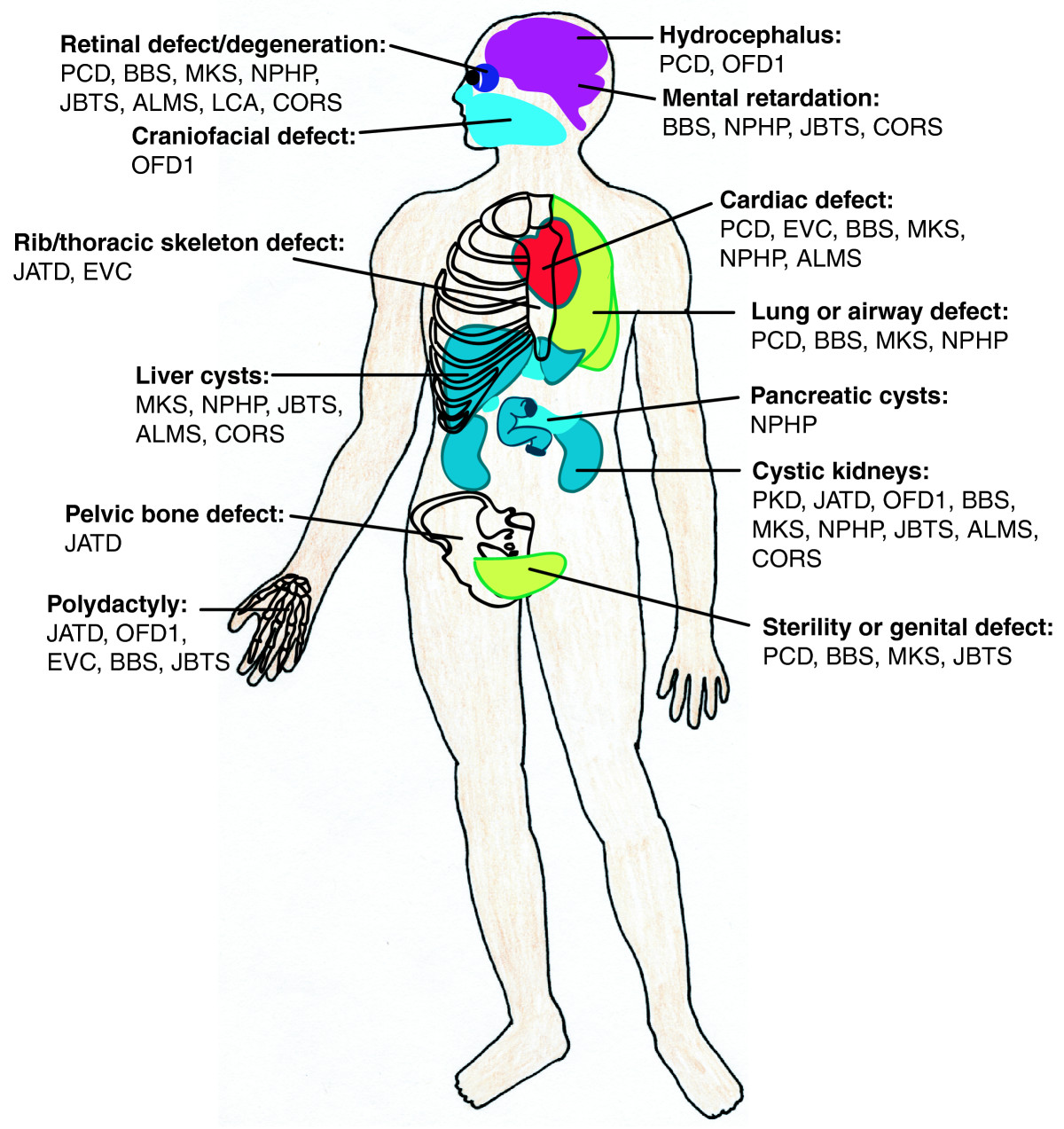 A systems-biology approach to understanding the ciliopathy disorders ...