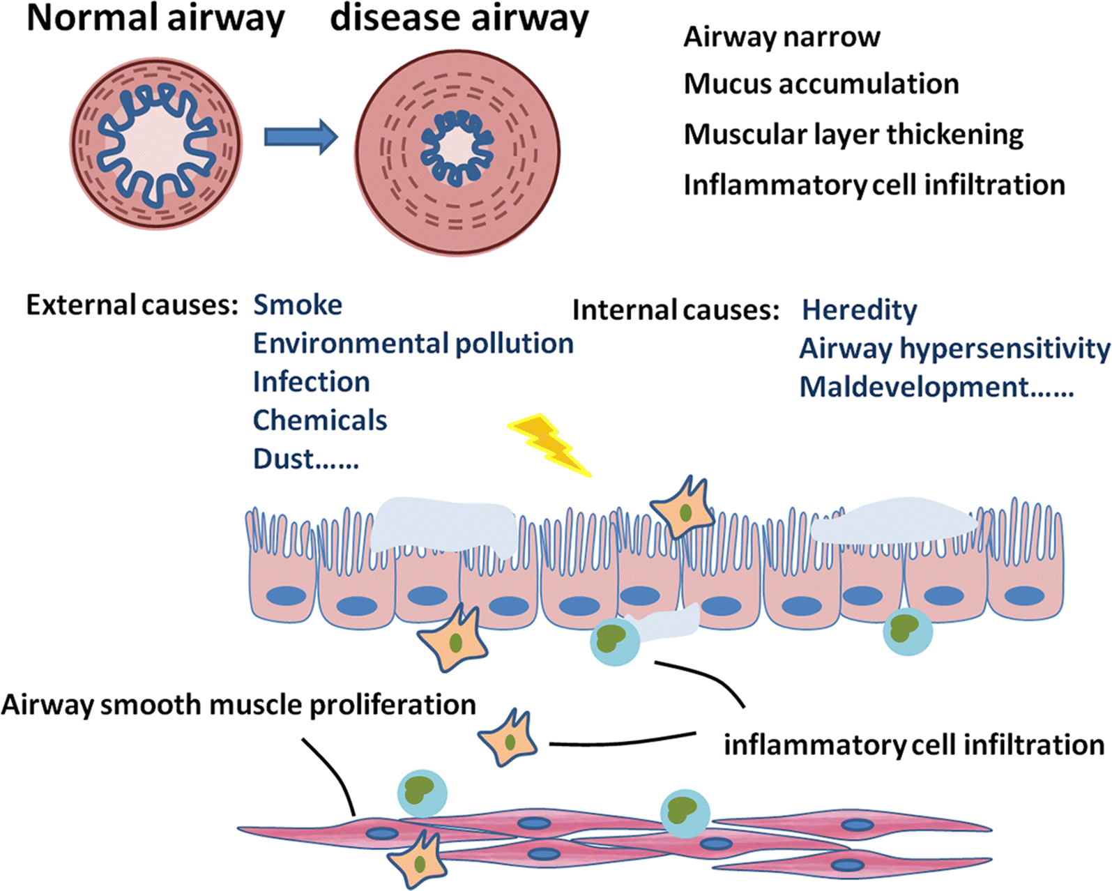 Roles of airway smooth muscle dysfunction in chronic obstructive ...
